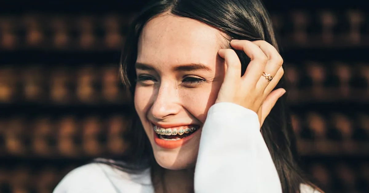 Power Chain Braces: Boost Your Smile Alignment Fast